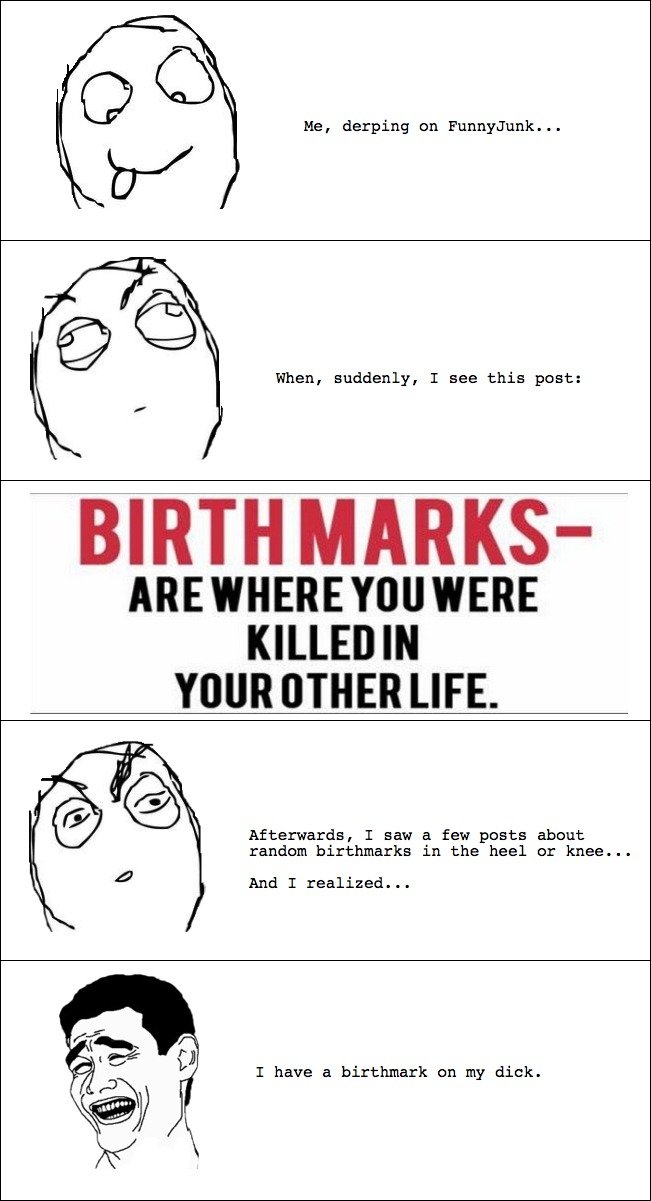 Birthmarks?